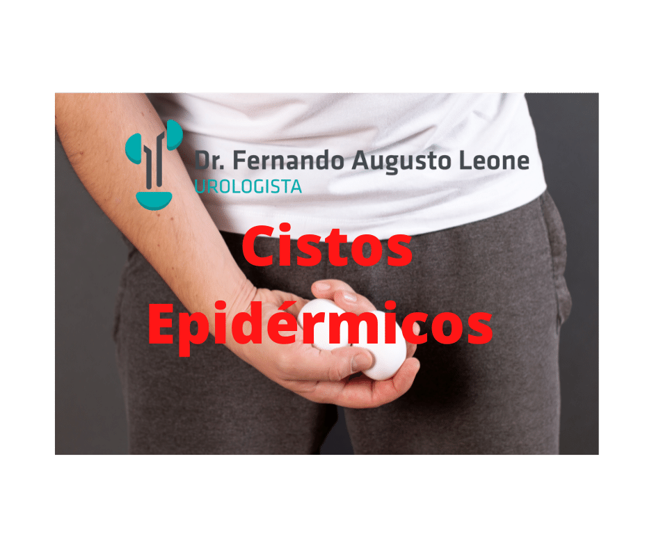 Cistos Na Cabeça Do Epididimo - RETOEDU