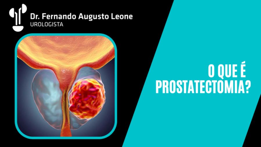 Prostatectomia - Dr. Fernando Leone - Urologista BH - Urologista BH
