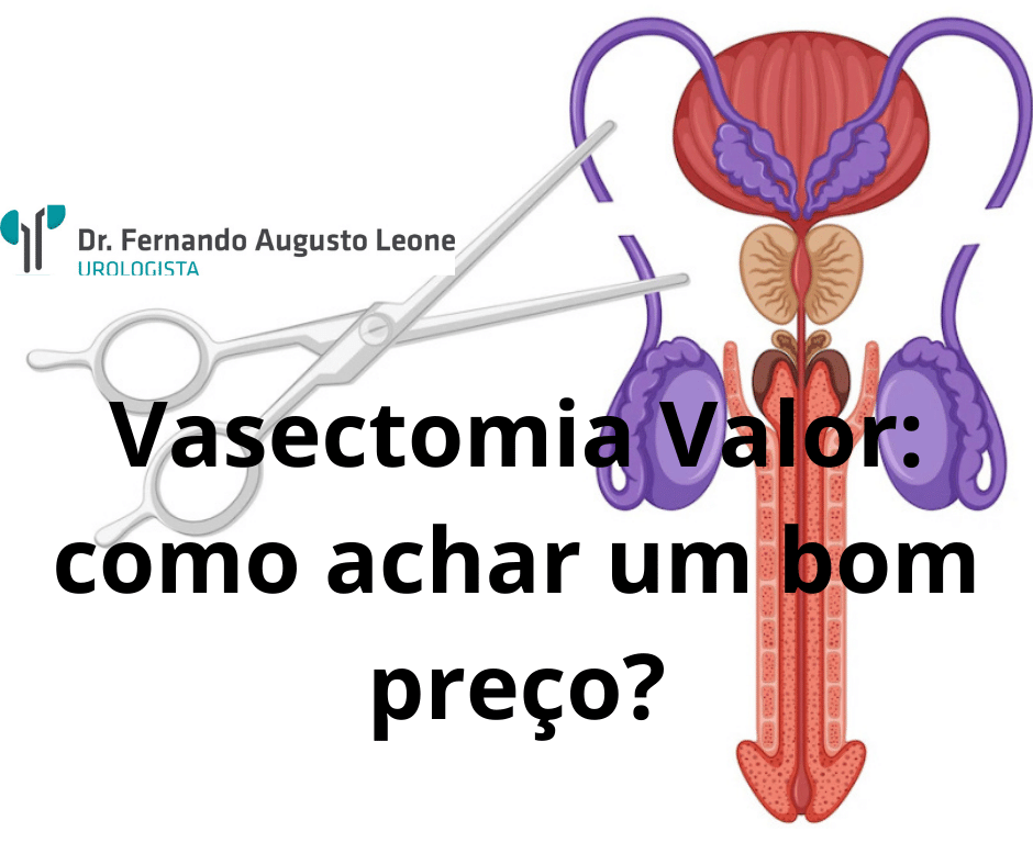 Vasectomia Valor: Como Achar Um Bom Preço? Dr. Leone Uro BH