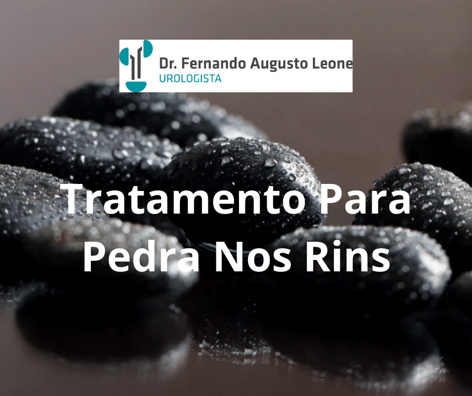 Tratamento Para Pedra Nos Rins - Dr. Fernando Leone - Urologista BH ...