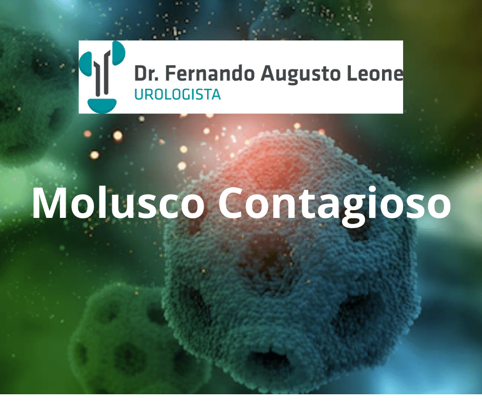 Molusco Contagioso - Dr. Fernando Leone - Urologista BH - Uro BH