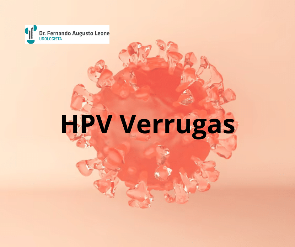 HPV Verrugas - Dr. Fernando Leone - Urologista BH BH