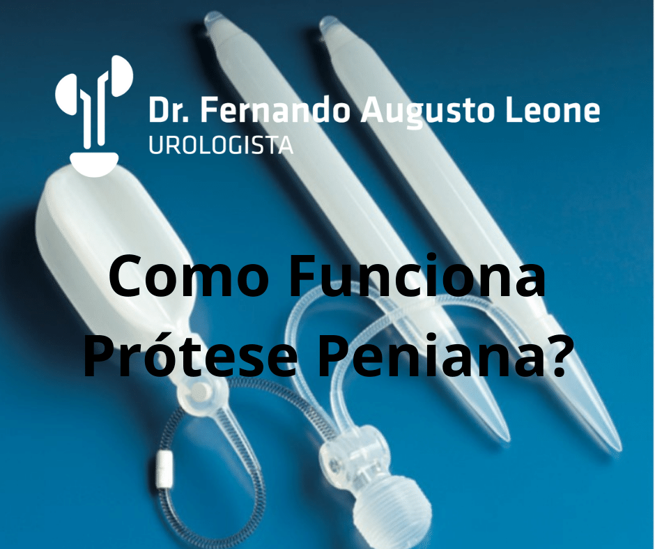 Como Funciona Prótese Peniana? - Dr. Fernando Leone - Urologista BH