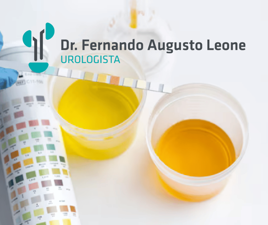 Ureaplasma parvum: Sintomas, Diagnóstico e Tratamento - Dr. Fernando ...