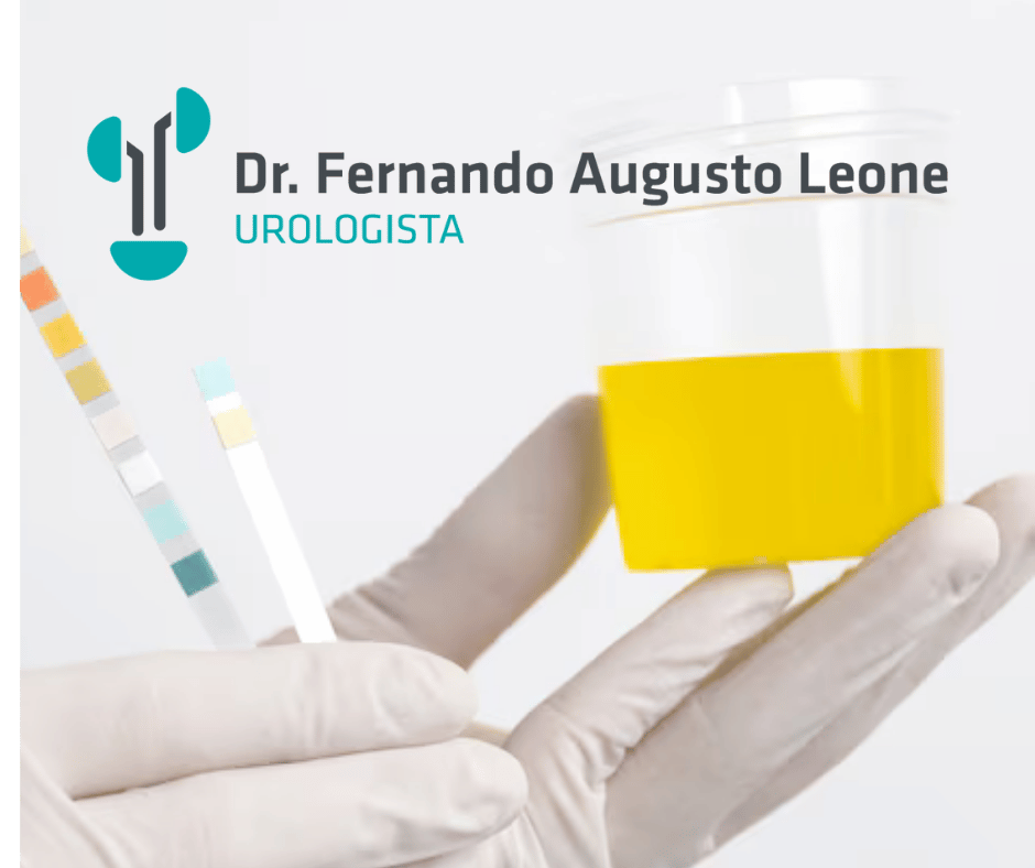 Oxalato de Cálcio na Urina: Causas, Sintomas e Tratamentos - Dr ...