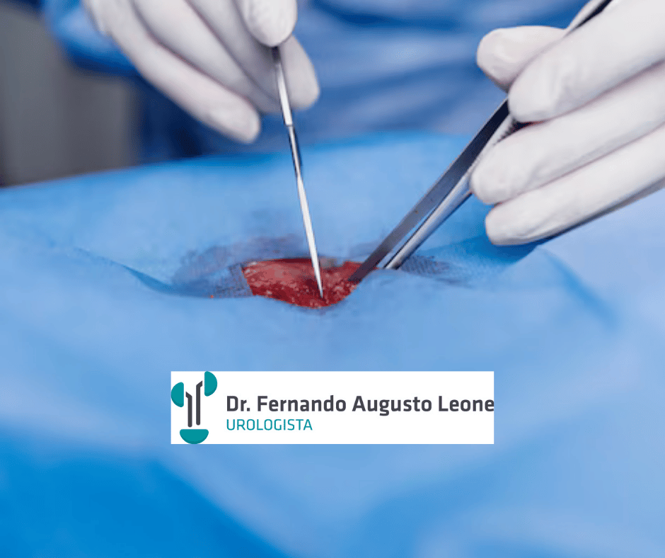 Estreitamento do Prepúcio: Causas, Sintomas e Tratamentos - Dr ...