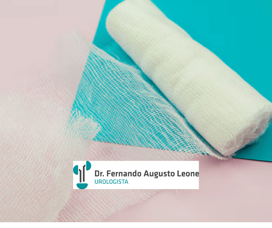 7 Dias Após Postectomia: O Que Esperar e Como Cuidar - Dr. Fernando ...